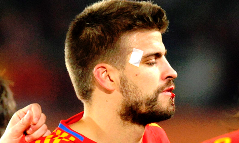 Así captaron las imágenes: Mire como fue el golpe del defensa español ...