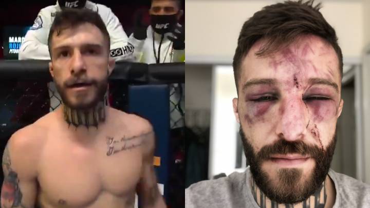 UFC: Así quedó el rostro de Marcelo Rojo tras su debut en el octágono ...