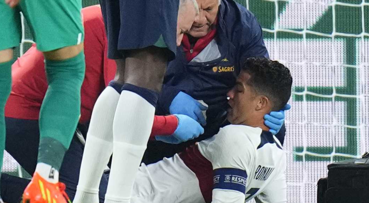 ¡Irreconocible! La dura imagen de Cristiano Ronaldo con medio tabique ...